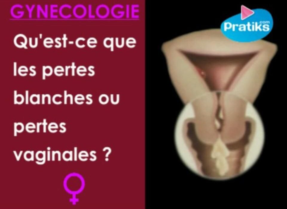 Qu'est ce que les pertes blanches ou pertes vaginales ? - Pratiks Qu'est ce que les pertes blanches ou pertes vaginales ? - Pratiks